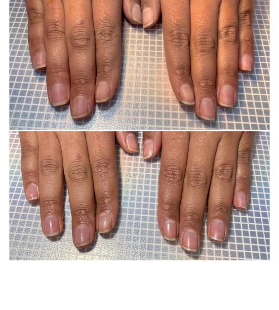 IBX Nail Treatment: Strengthen and Repair Damaged Nails | Treatwell